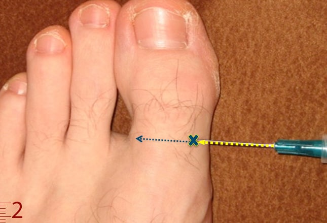 Best Practices: Regional Blocks