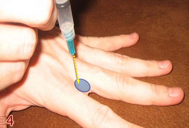 Best Practices: Regional Blocks