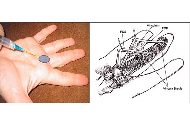 Best Practices: Regional Blocks