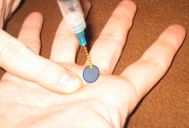 Best Practices: Regional Blocks