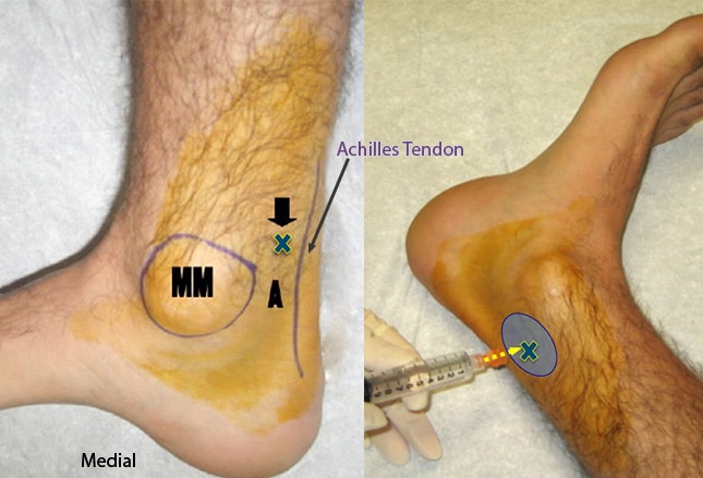 Best Practices: Regional Blocks