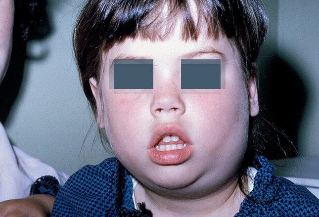 Back-to-School Viral Illnesses: 7 Classroom Contagions