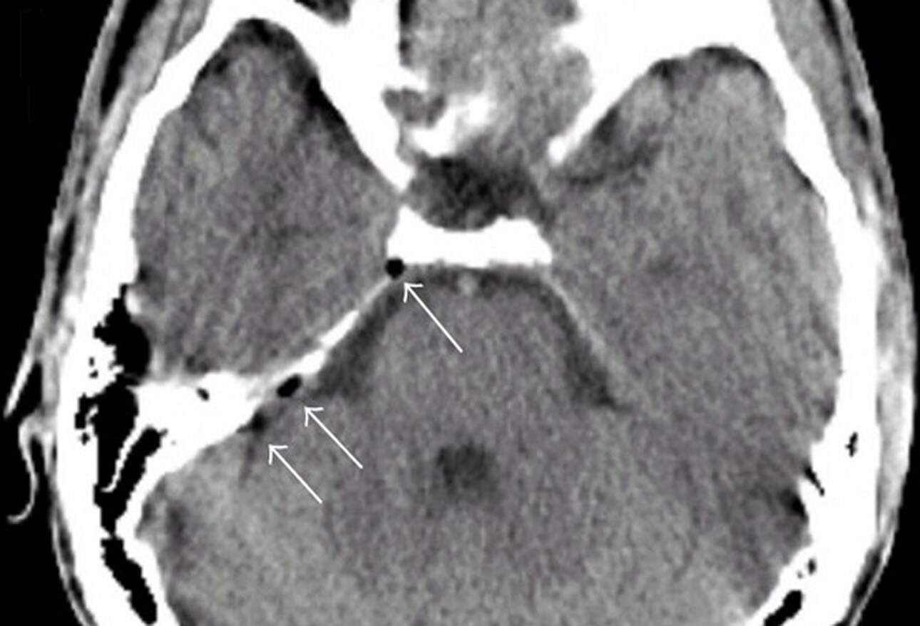 Scuba Diving Injuries and Underwater Hazards