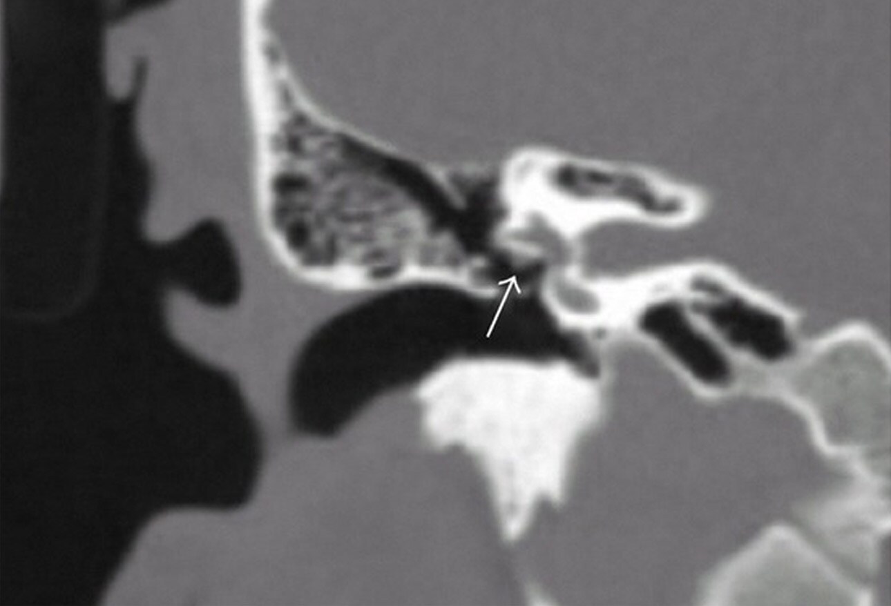 Scuba Diving Injuries and Underwater Hazards