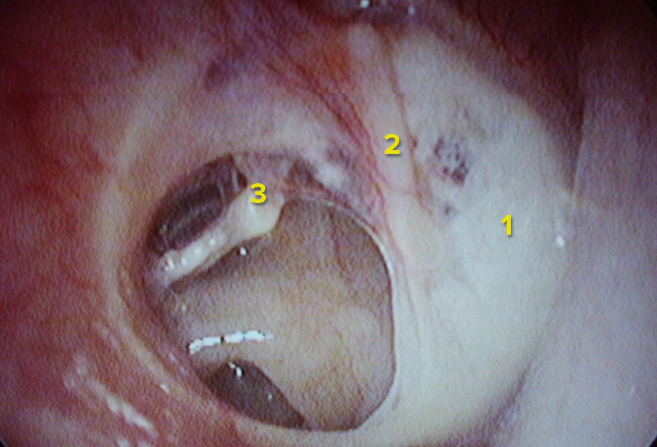 Scuba Diving Injuries and Underwater Hazards