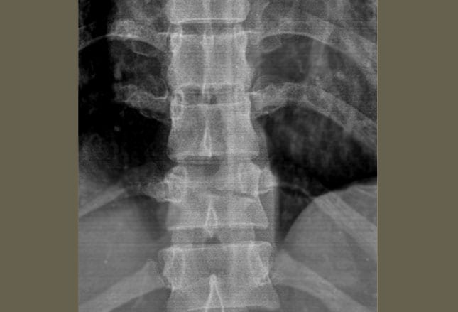 Recognizing and Treating Common Sports Injuries