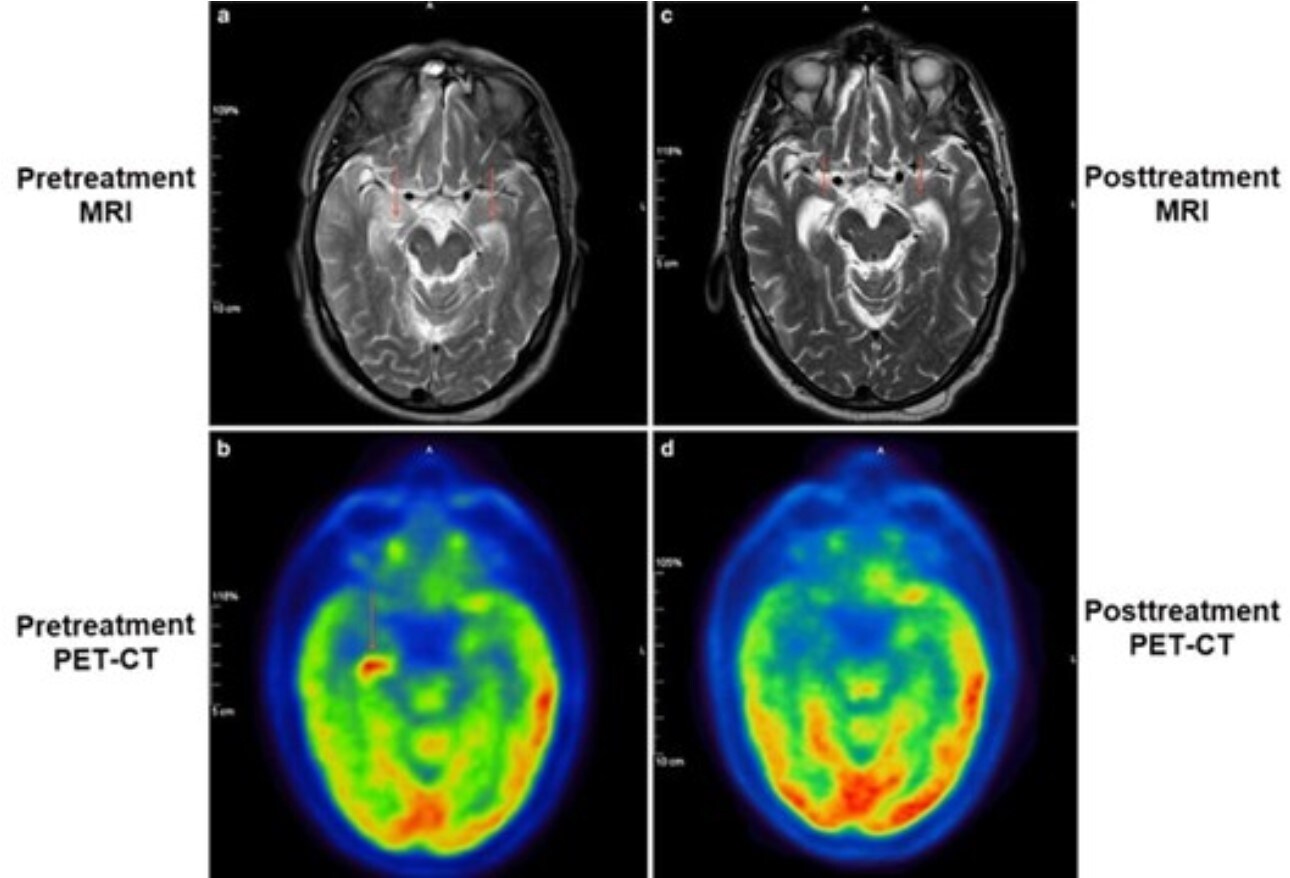 Visual Findings of 9 Sexually Transmitted Infections