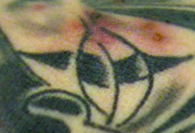 Skin Inflammation Tattoos