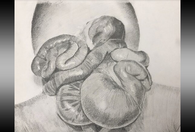 Training Doctors to Draw: Increasing Patient Communication Through ...