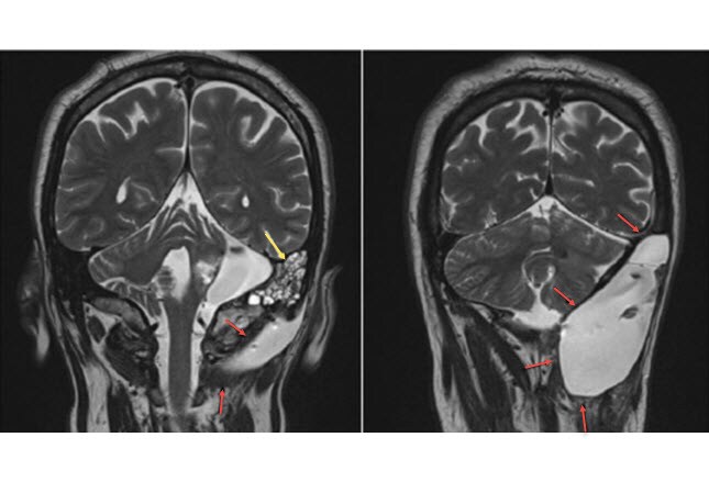 7 Potentially Devastating Traumatic Brain Injuries