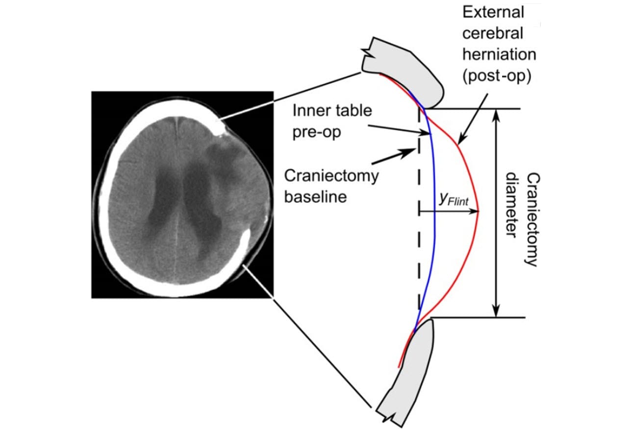 Seven Potentially Devastating Traumatic Brain Injuries