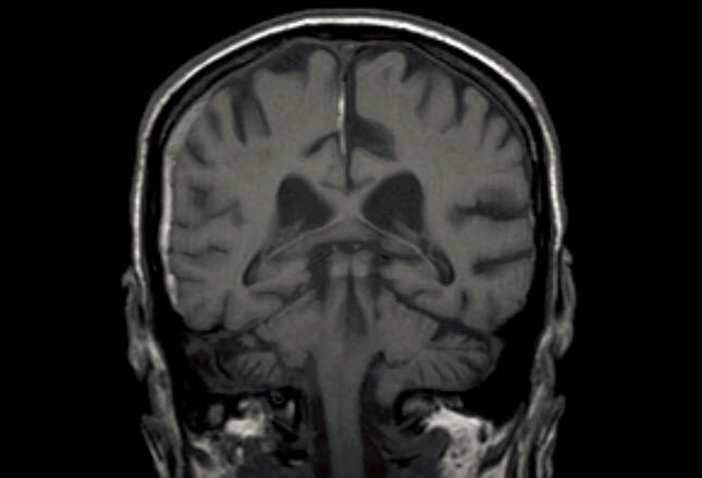 Seven Potentially Devastating Traumatic Brain Injuries