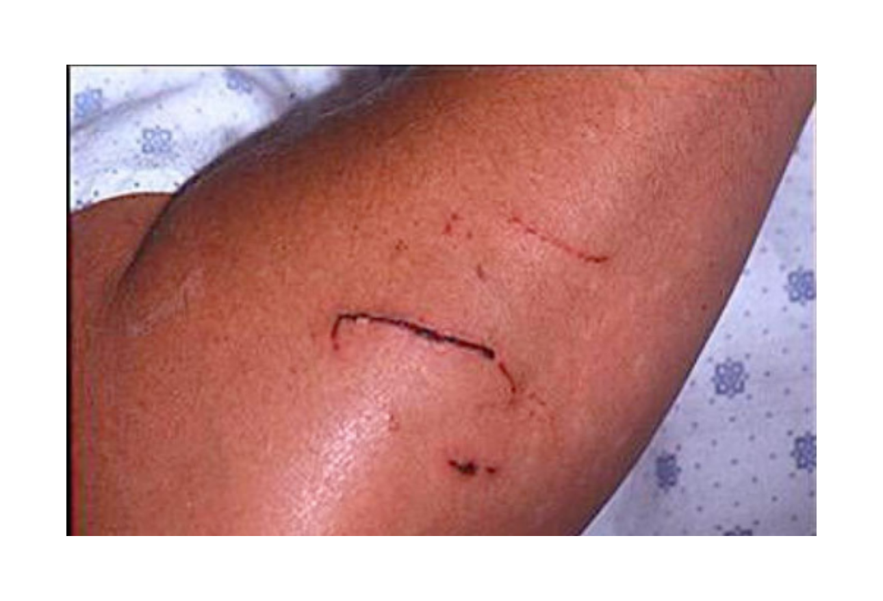 11 Travel Diseases You Need to Know