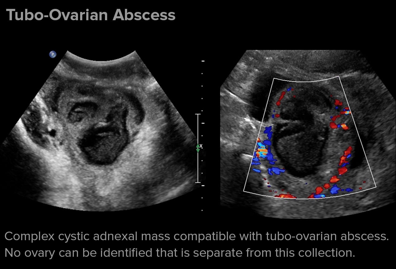 10 Can't Miss Ultrasound Diagnoses