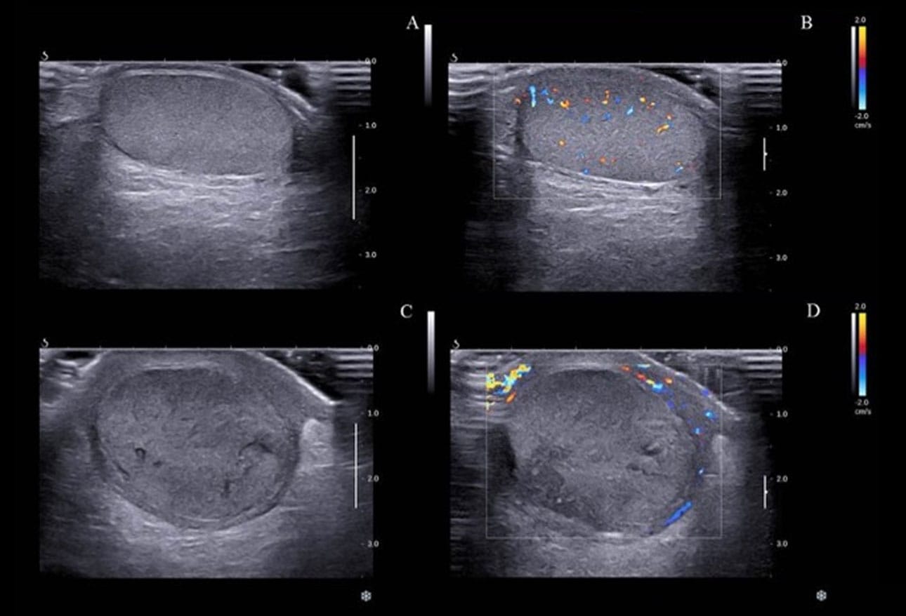 10 Can't Miss Ultrasound Diagnoses