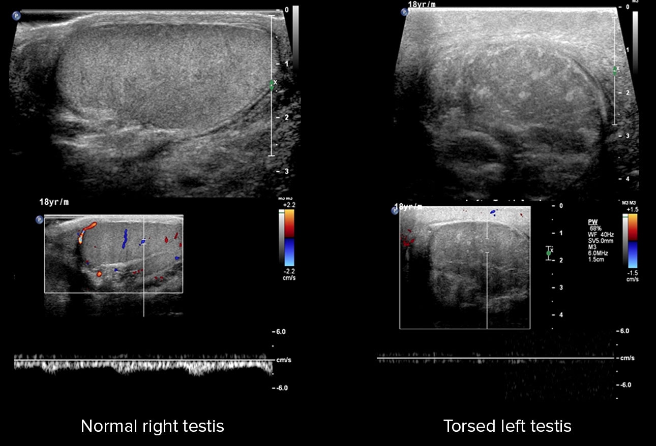 10 Can't Miss Ultrasound Diagnoses