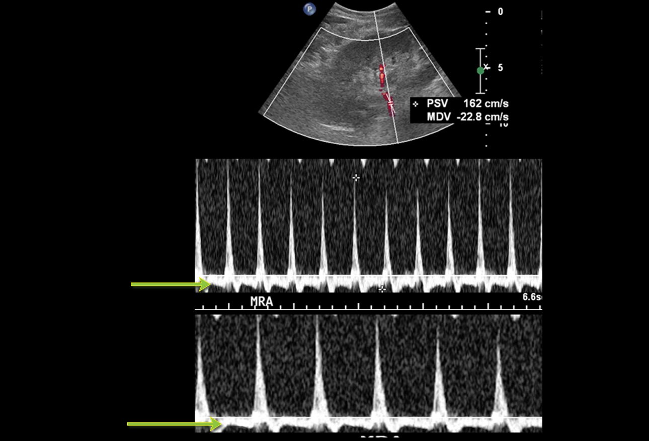 10 Can't Miss Ultrasound Diagnoses