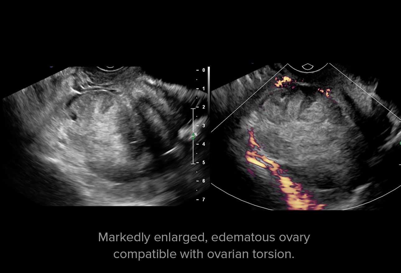 10 Can't Miss Ultrasound Diagnoses