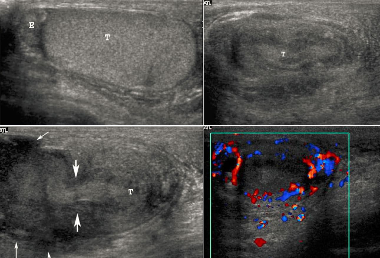 10 Can't Miss Ultrasound Diagnoses