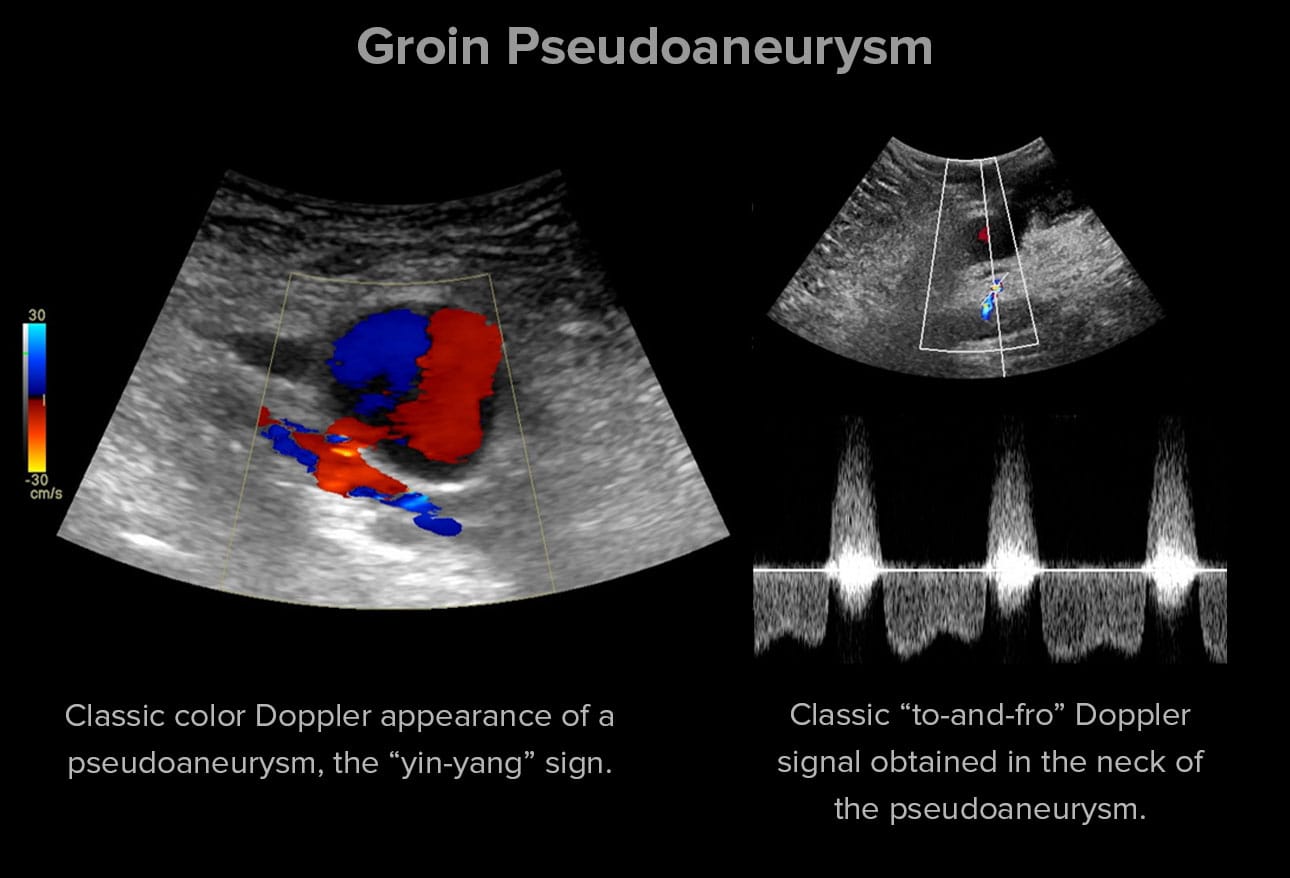 10 Can't Miss Ultrasound Diagnoses