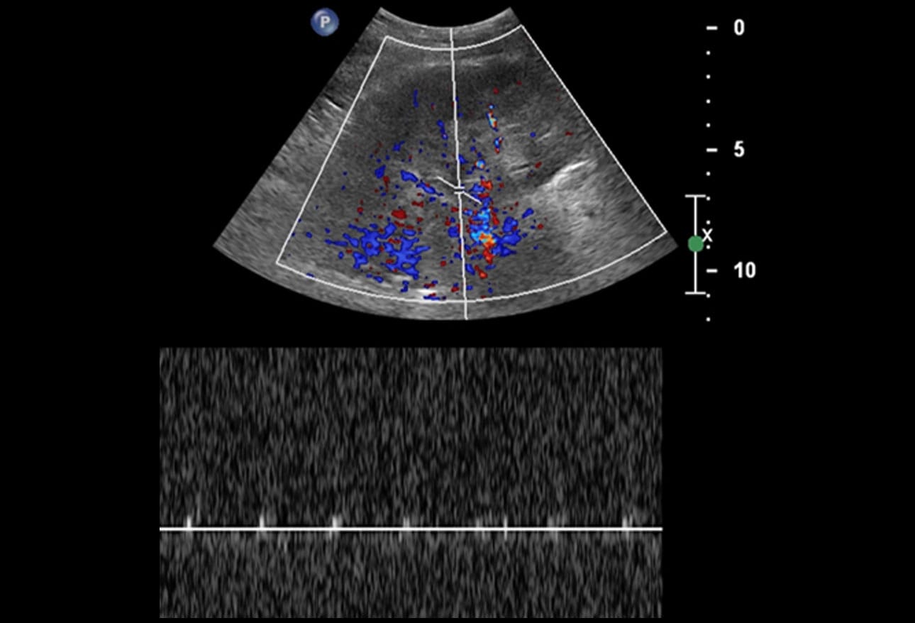 10 Can't Miss Ultrasound Diagnoses