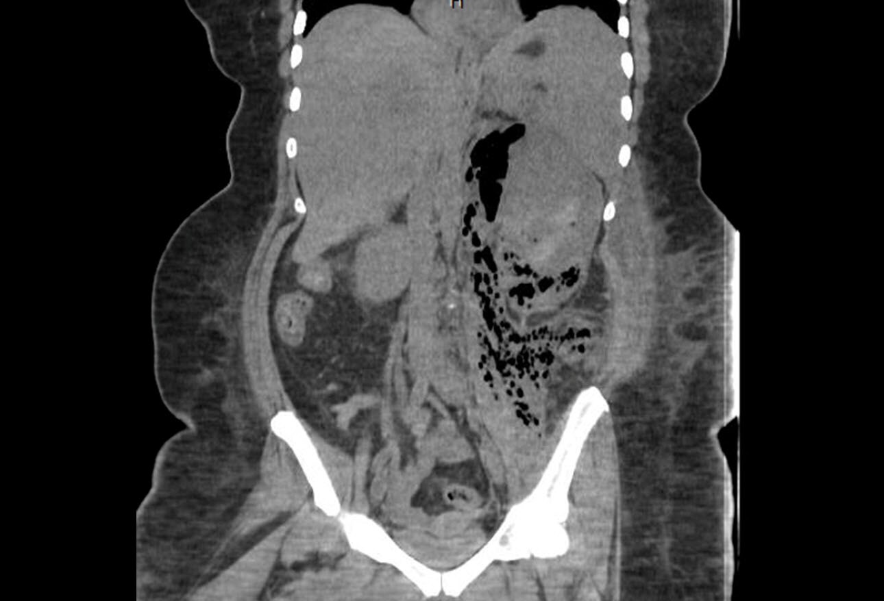 Urinary Tract Infections: A Spectrum of Pathologies and Challenges