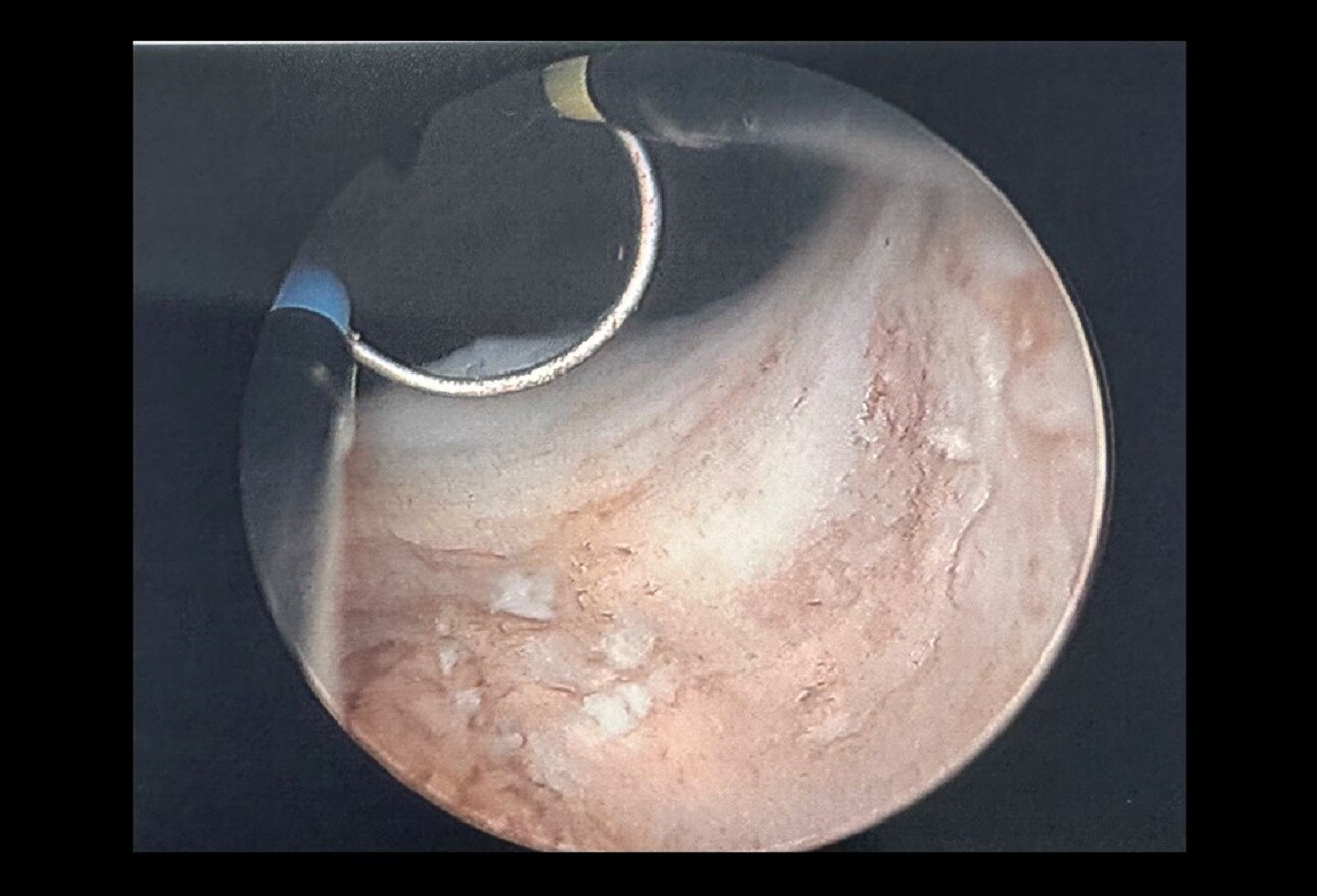 Urinary Tract Infections: Pathologies and Challenges