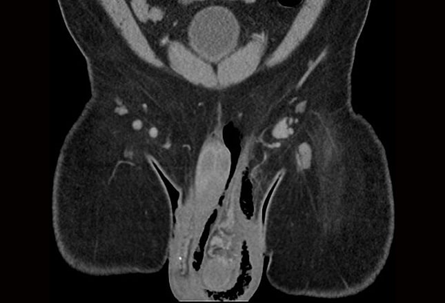 12 Urologic Emergencies You Need to Know