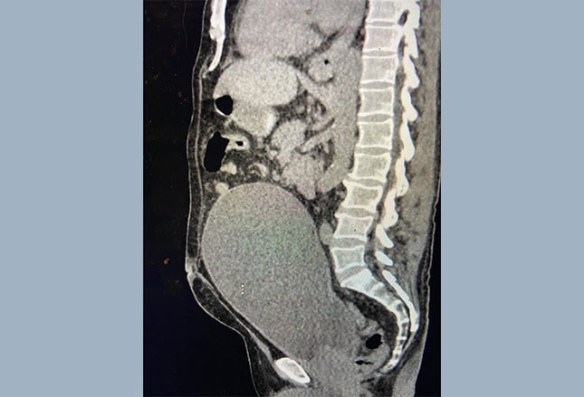 11 Urologic Emergencies You Need to Know