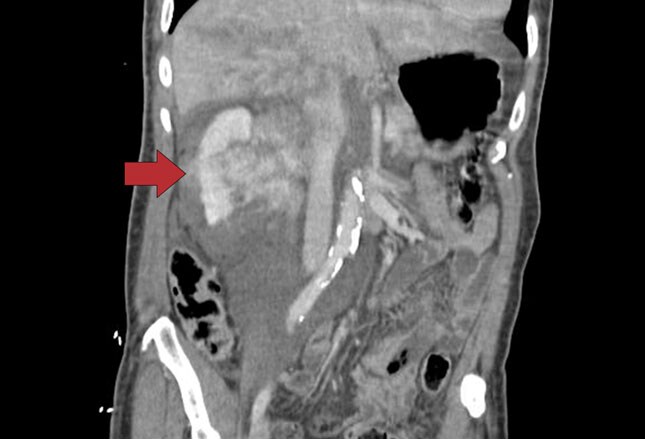 11 Urologic Emergencies You Need to Know