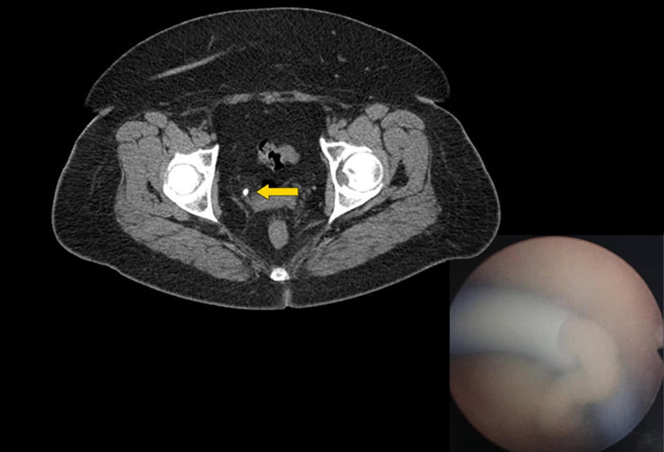 11 Urologic Emergencies You Need to Know
