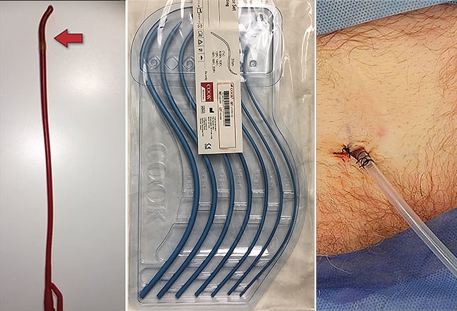 11 Urologic Emergencies You Need to Know