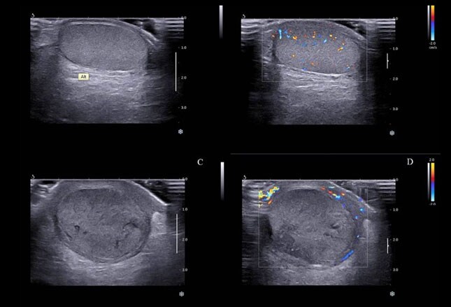 11 Urologic Emergencies You Need to Know