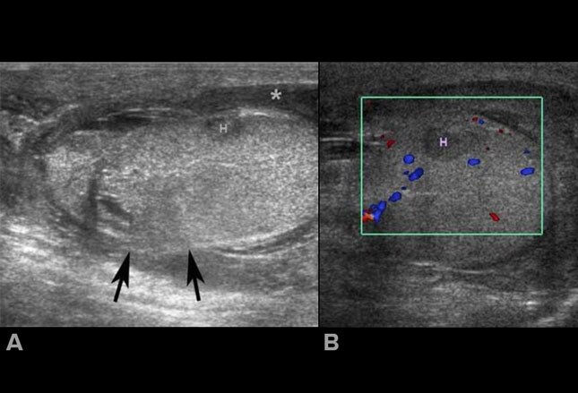 11 Urologic Emergencies You Need to Know