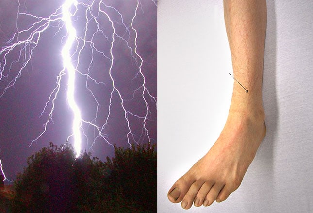 10 Common Wilderness and Environmental Medical Illnesses and Injuries