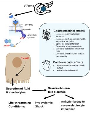 VIPomas: Background, Pathophysiology and Etiology, Epidemiology