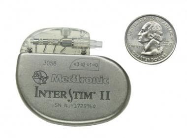 Fecal Incontinence Treatment & Management: Medical Therapy, Surgical ...