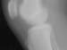 Osgood-Schlatter Disease Imaging: Practice Essentials, Radiography