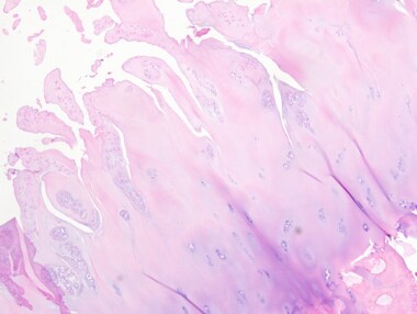 Osteoarthritis: Practice Essentials, Background, Anatomy