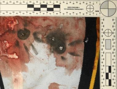 Forensic Pathology of Firearm Wounds: Overview, Modern Ammunition ...