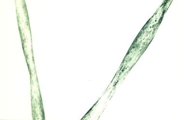 显微照片显示有规则的节点和实习生