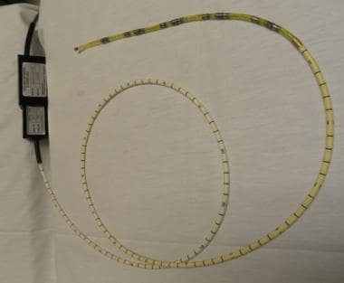 Esophageal Manometry Test Uses Side Effects Procedure Esophagoscopy