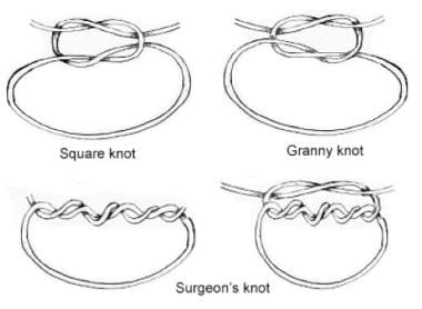 Spinal Cord Stimulation Technique: Approach Considerations, Device ...