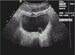Vesicoureteral Reflux Imaging: Practice Essentials, Radiography ...