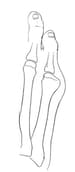 Fifth-Toe Deformities: Practice Essentials, Anatomy