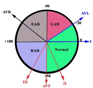 Electrocardiography Overview ECG Indications And Contraindications
