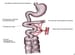 Intestinal Anastomosis: Practice Essentials, Background, Indications