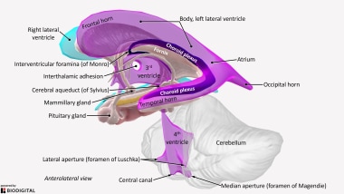 Ventricles of the Brain: Overview, Gross Anatomy, Microscopic Anatomy