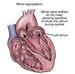 Mitral Valve Anatomy: Overview, Gross Anatomy, Microscopic Anatomy