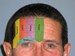Forehead Anatomy: Surface Anatomy, Bones of the Forehead, Forehead and ...